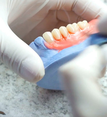 Prótesis Maxilofacial MX | Prótesis Maxilofacial y Odontología ...